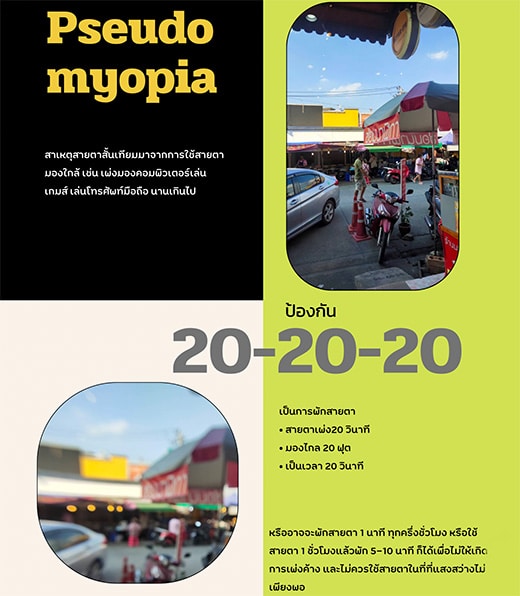 Pseudomyopia - Better-eye Progressive center